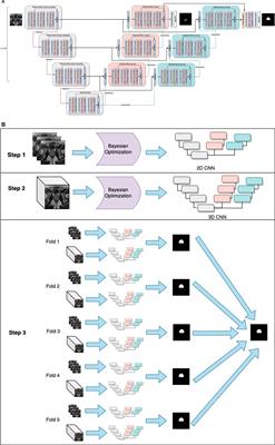 Frontiers | A multi-object deep neural network architecture to detect prostate anatomy in T2 ...